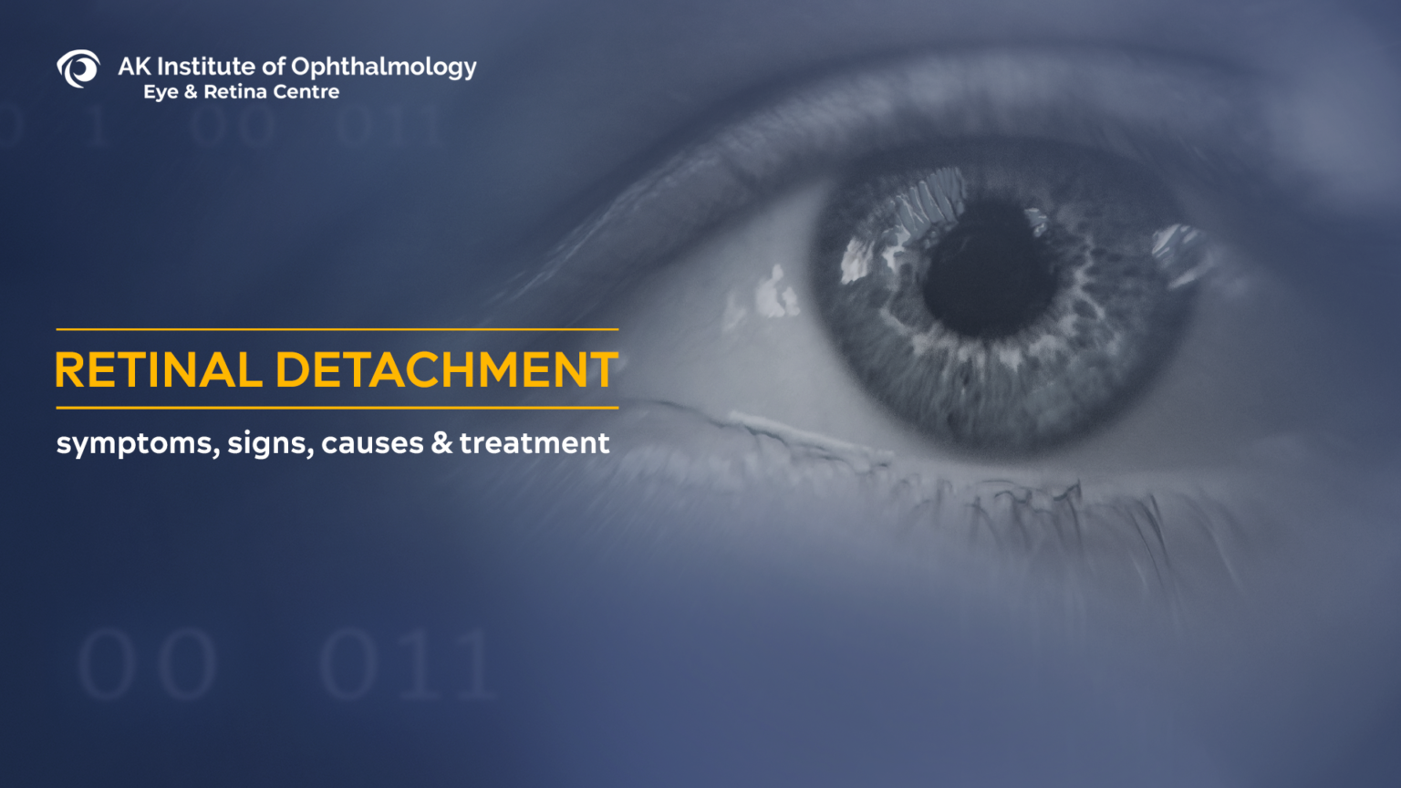 Retinal Detachment: Symptoms, Causes & Surgery in Delhi