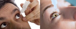 Dilated Eyes: Symptoms, Causes & What It Means