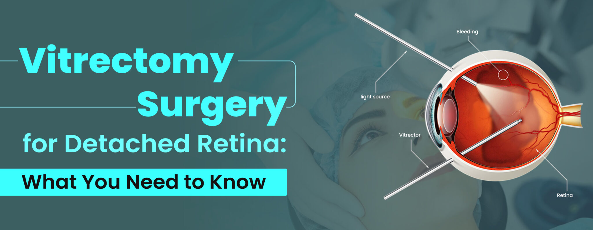 Vitrectomy Surgery for Detached Retina: Full Guide & Recovery