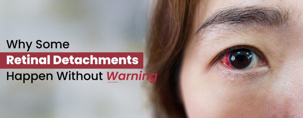 Why Retinal Detachments Happen Without Warning